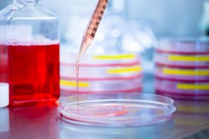 Lab-grown Bone Cells May Predict Gaucher Patients' Response to Therapy